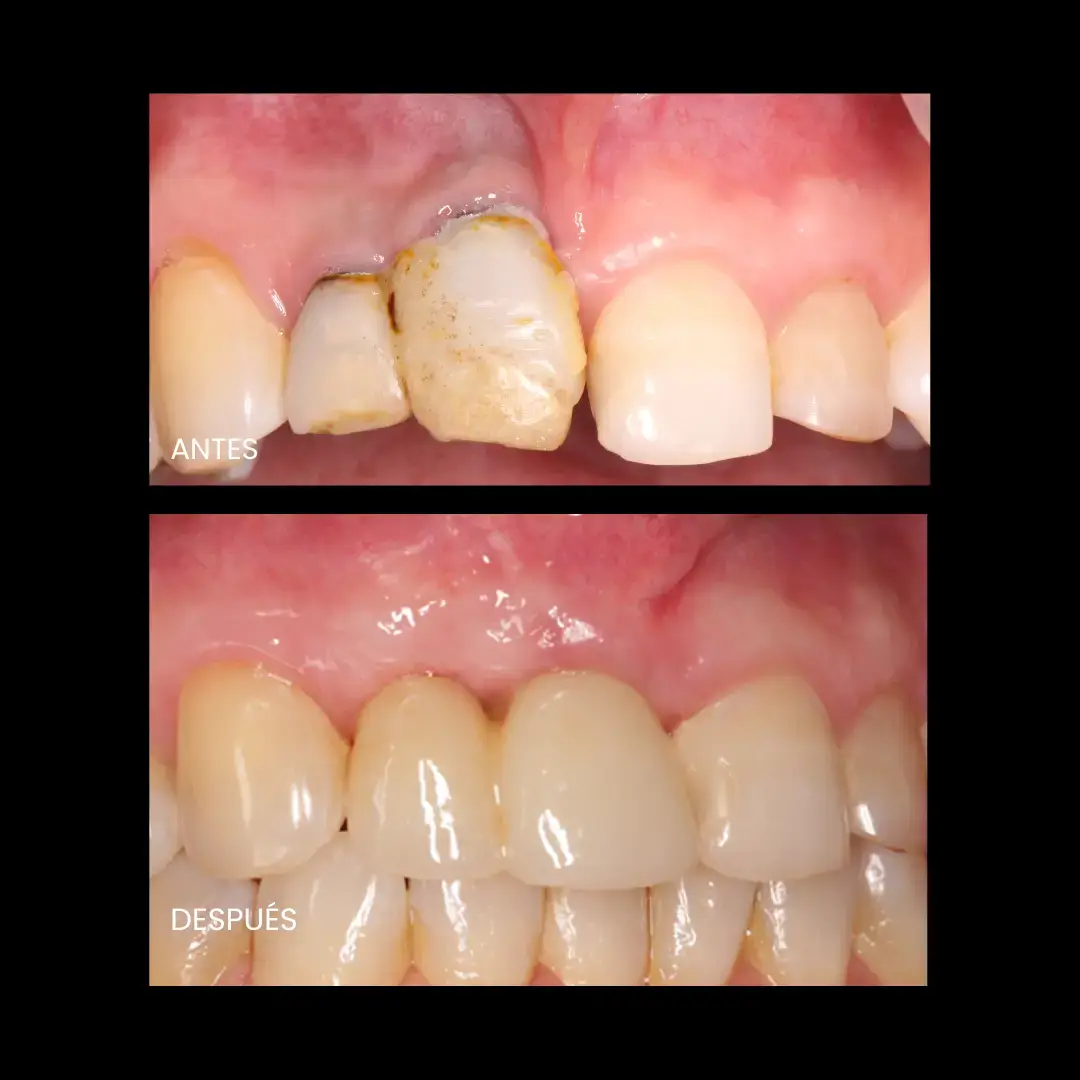 Home Dr Francisco Ortiz Cirujano Dentista E Implantólogo